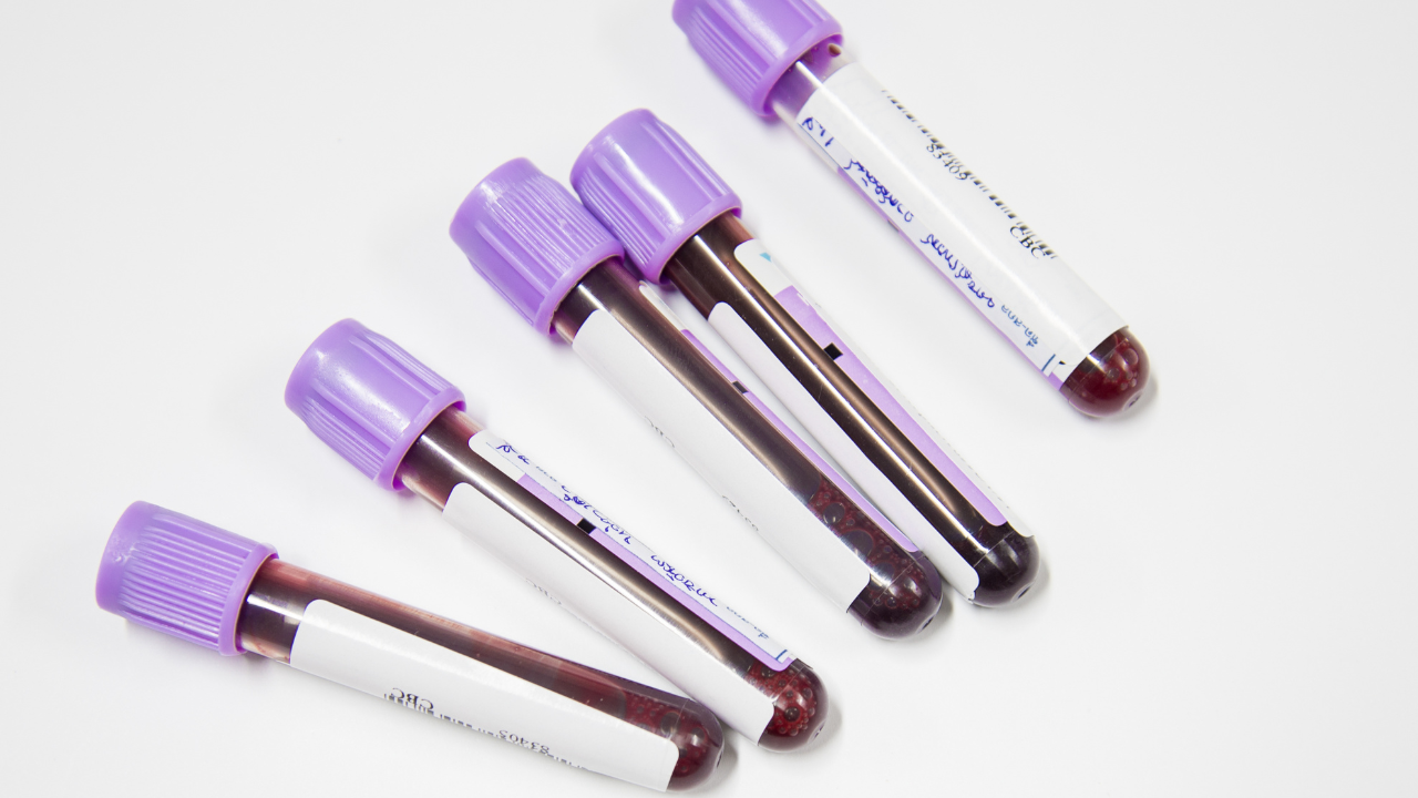Optimal Vs Normal Labs In Fertility Optimal Vs Normal Labs In Fertility