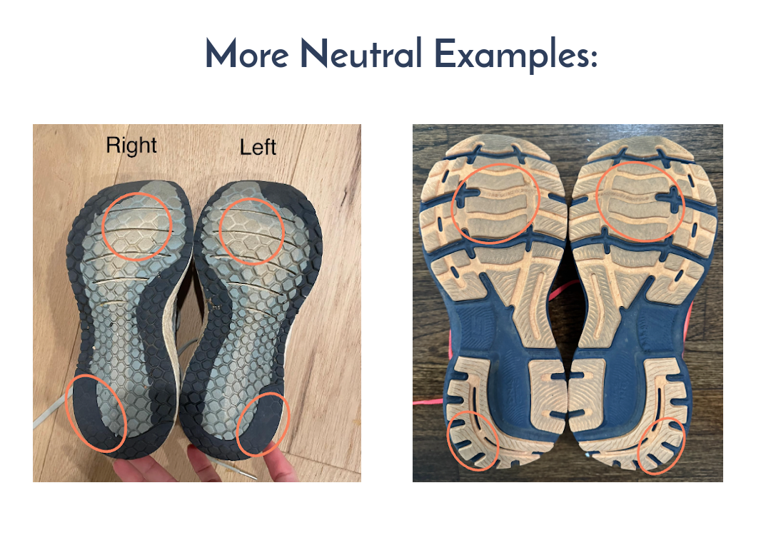 Pronation Based On Shoe Wear