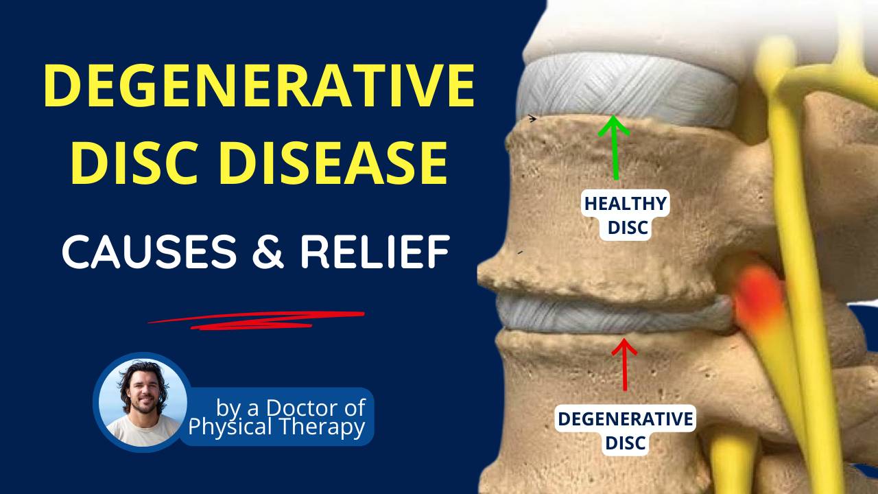Degenerative Disc Disease: Causes, Symptoms, and Back Pain Relief