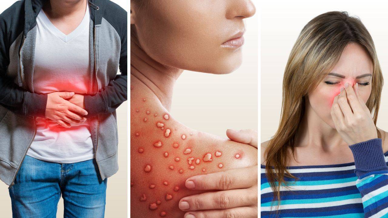 Stomach Pain, Rash, Sinusitis: The Salicylate Sensitivity Link