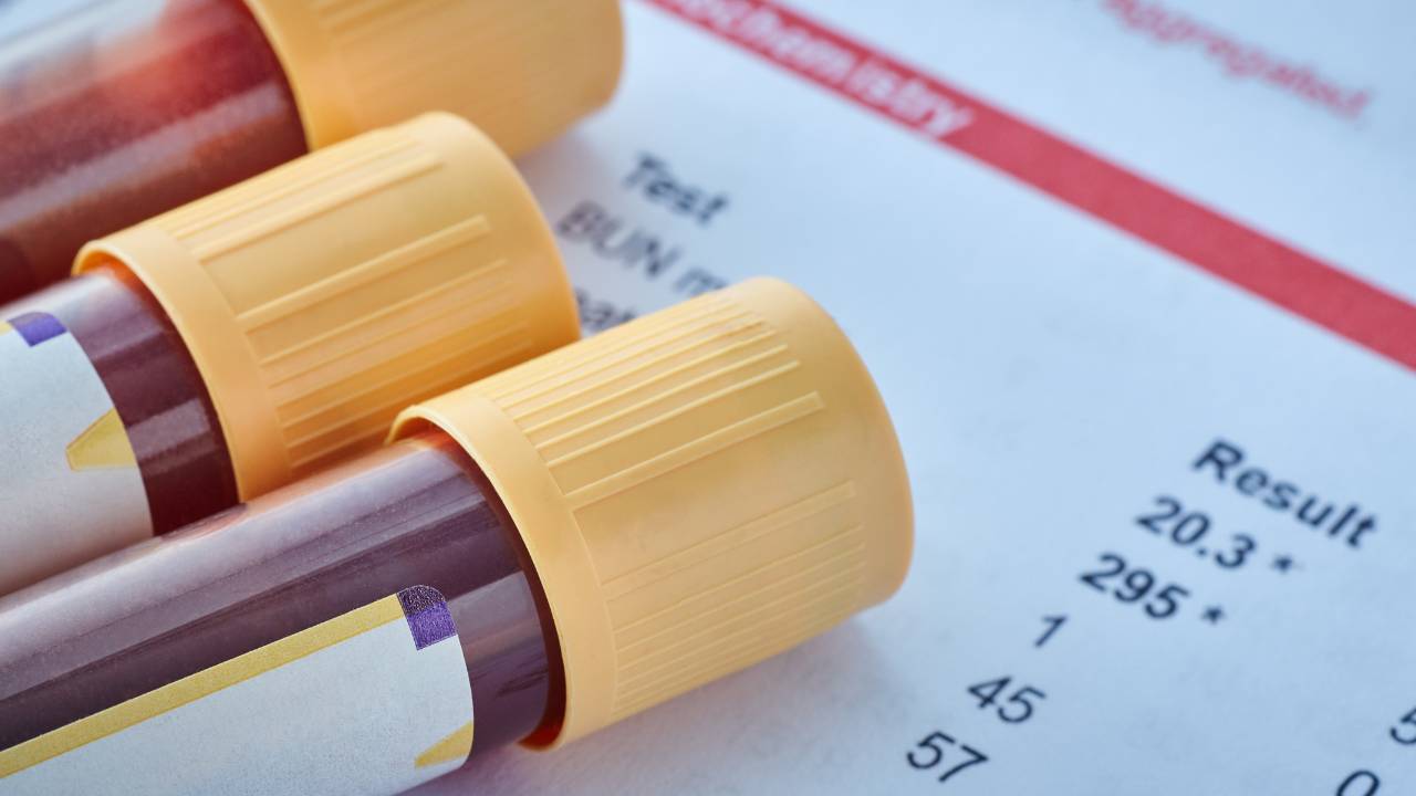 Know Your Blood Work Workshop