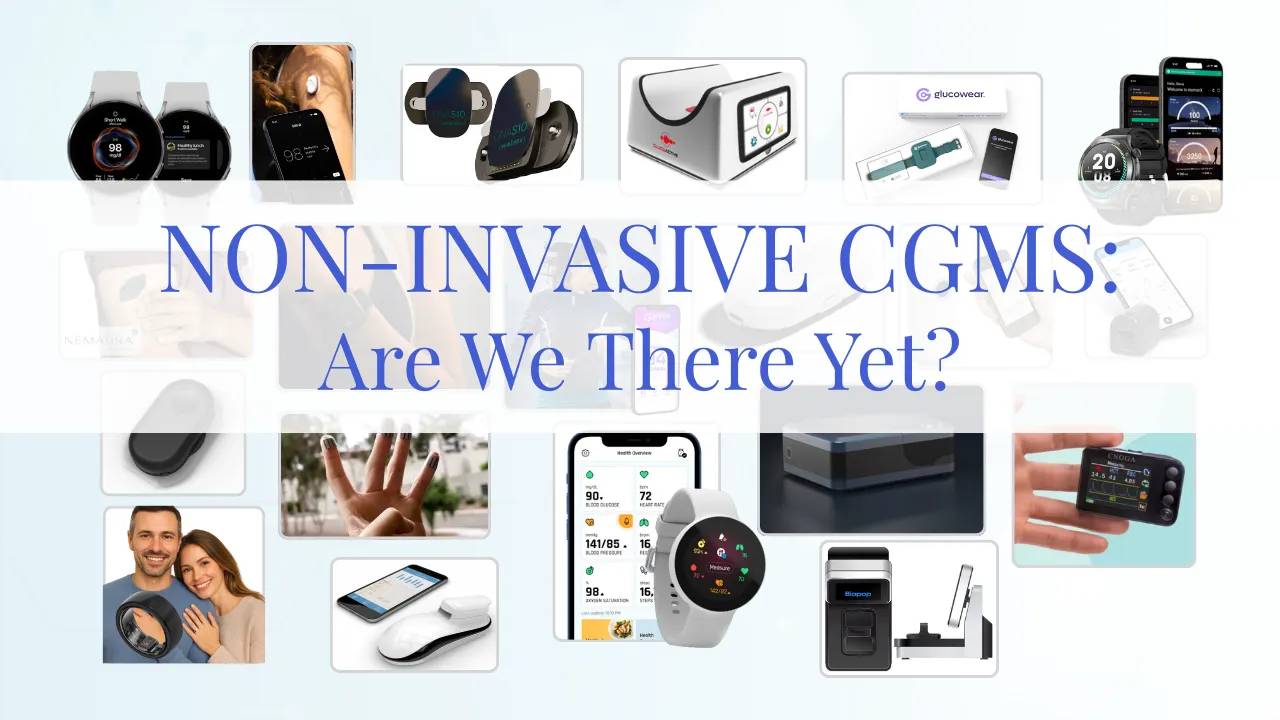 Non-Invasive CGMs: Are We There Yet?