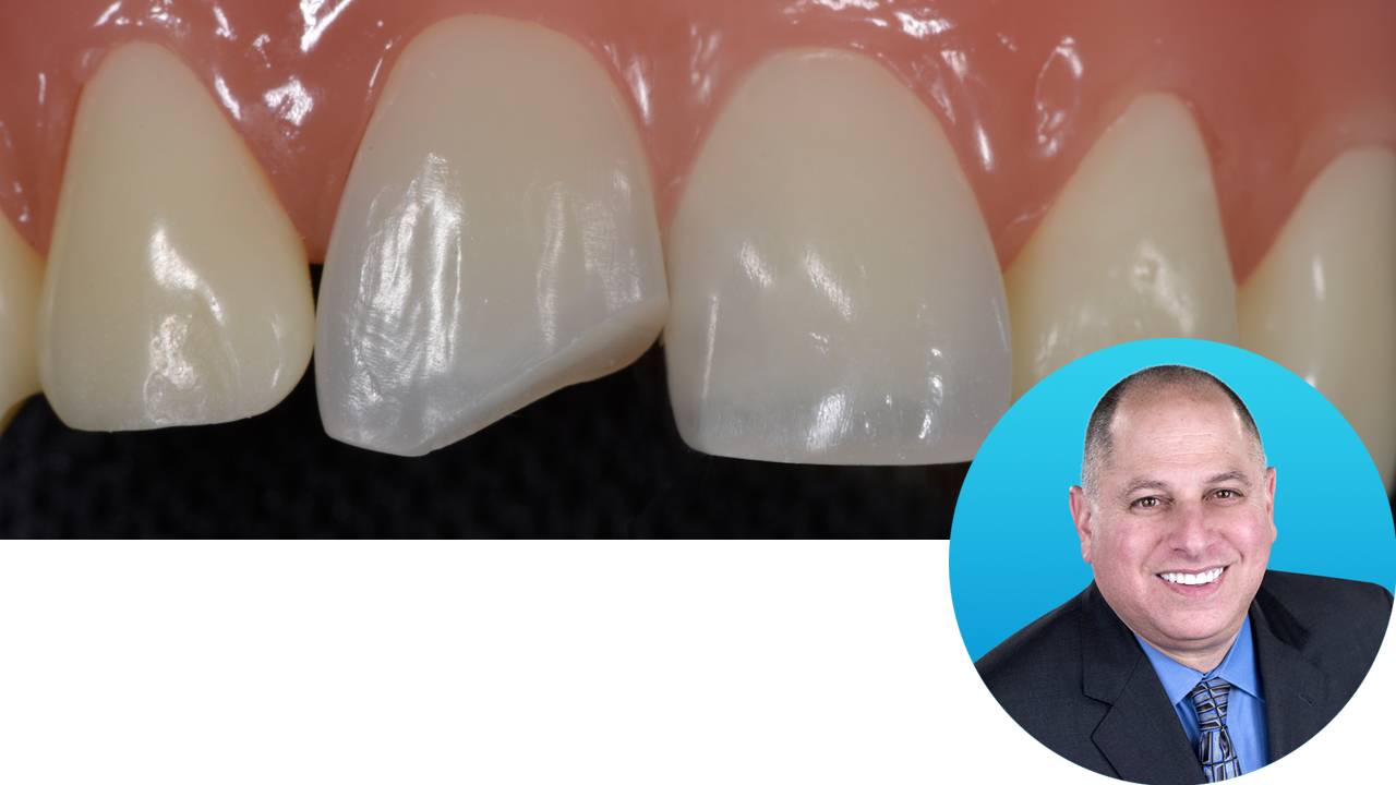 Invisible Class IV Incisal Restoration with Dr. Fred Peck