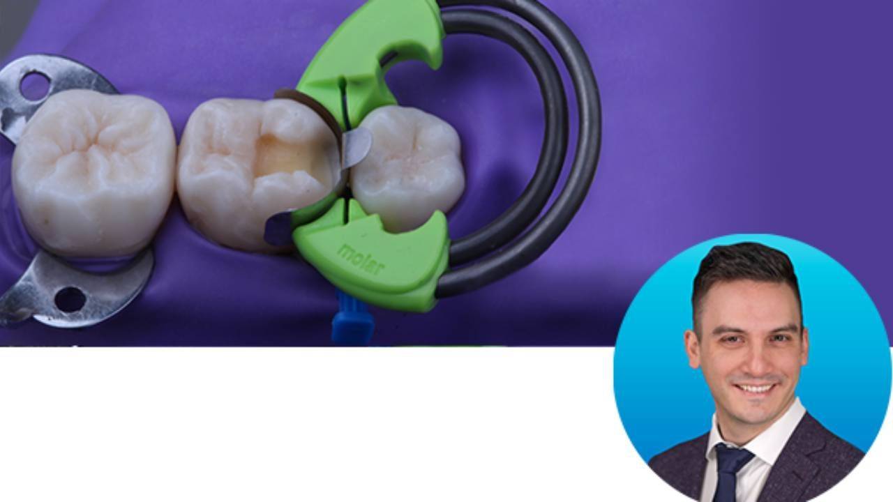 Materials to Improve your Direct Adhesive Dentistry