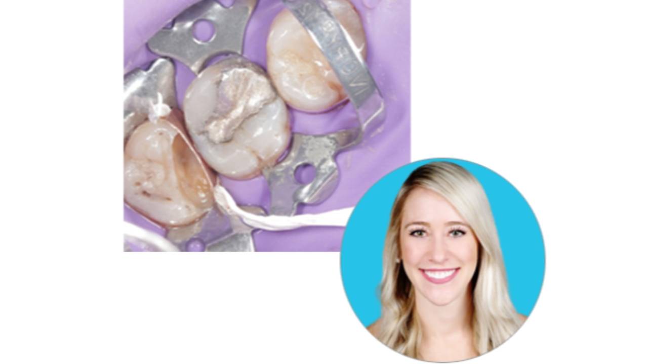 Consistent Protocols for Achieving Class II Success