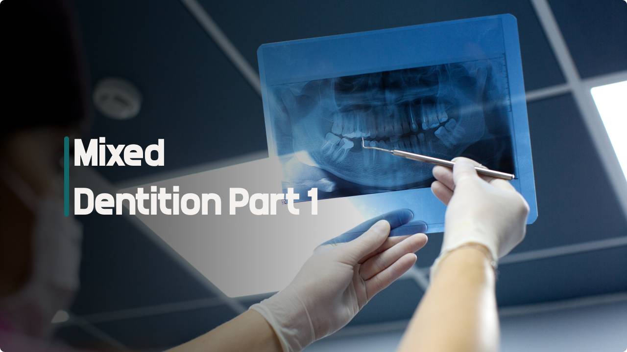 Mixed Dentition Part 1