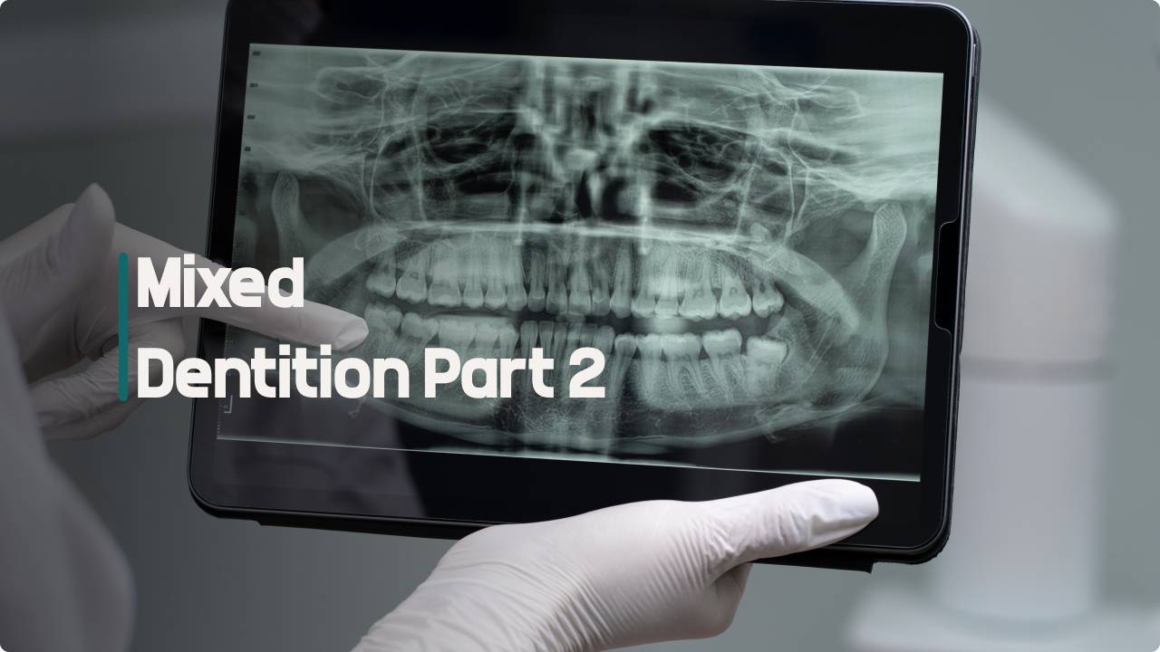 Mixed Dentition Part 1