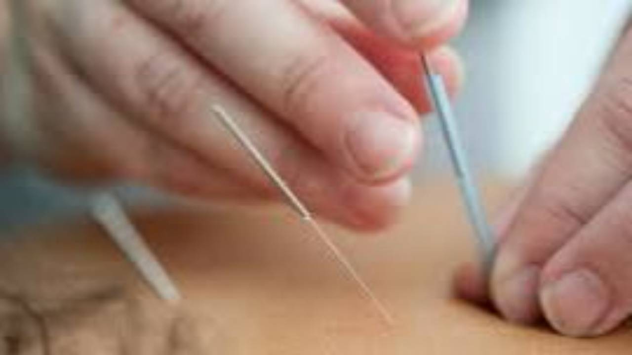 Dry Needling and Physical Therapy Columbus