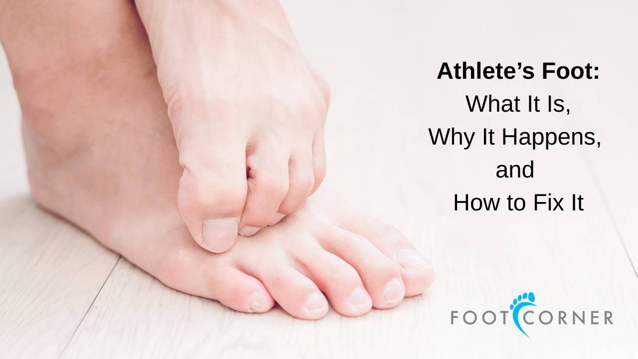 Athlete’s Foot: What It Is, Why It Happens, and How to Fix It