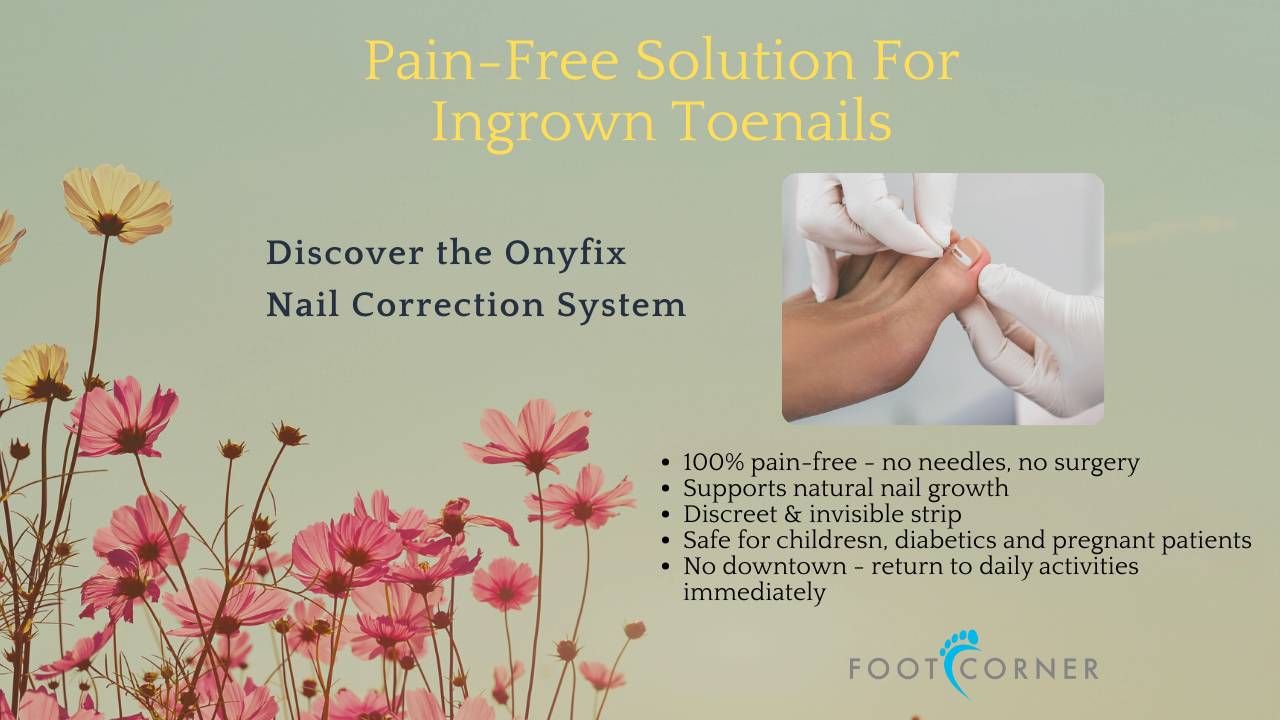 Ingrown Toenail Treatment Without Surgery-Onyfix Nail Correction