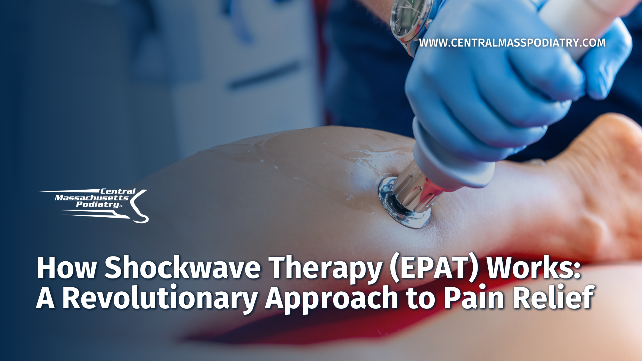 How Shockwave Therapy Relieves Pain? | Central MA Podiatry