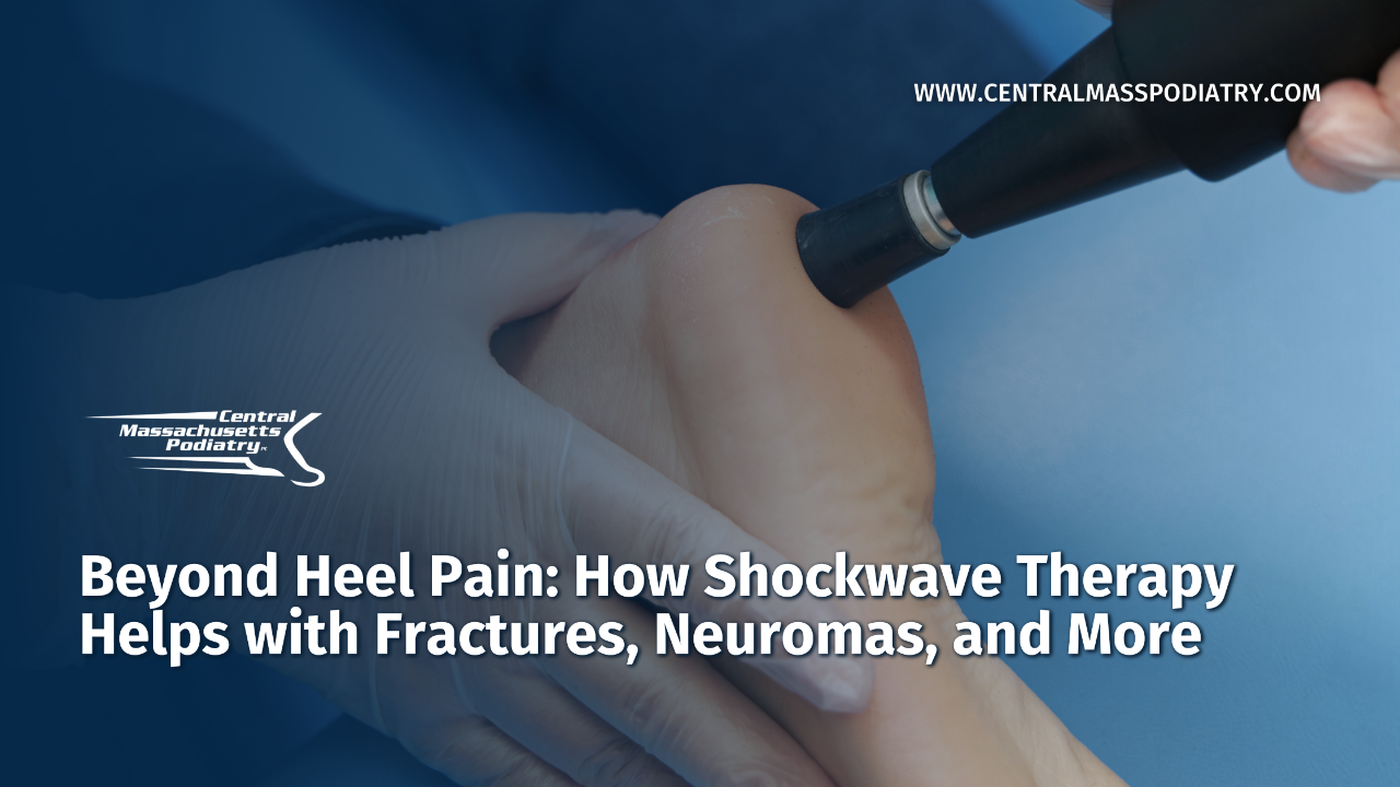 Shockwave Therapy: Beyond Heel Pain | Central MA Podiatry