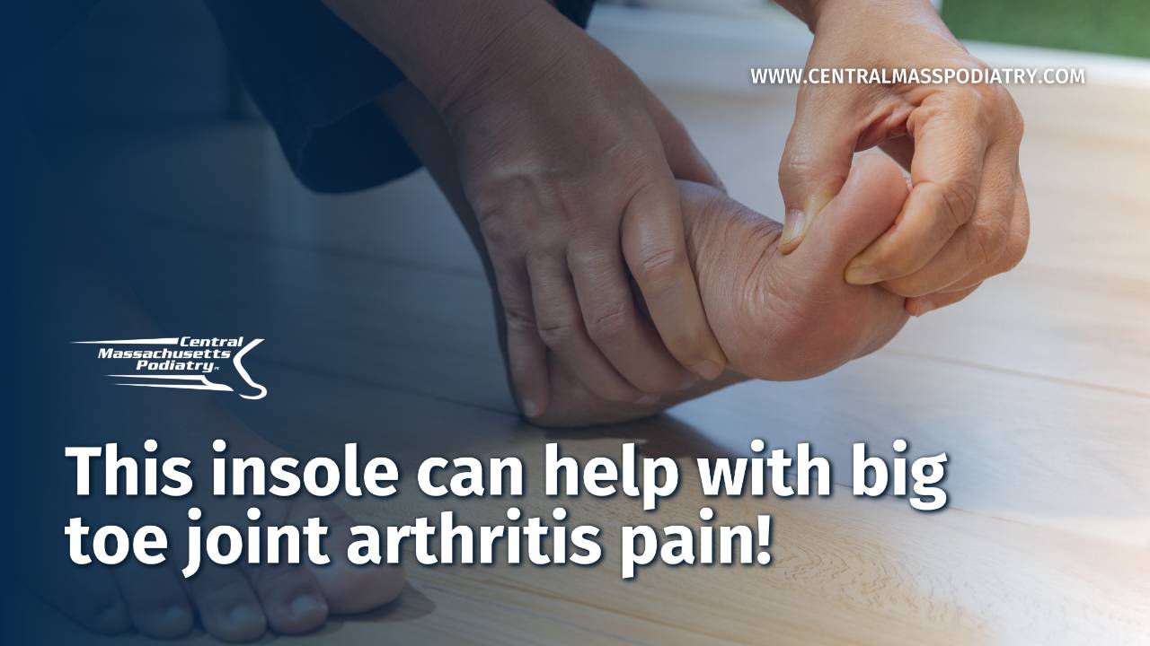 This insole can help with big toe joint arthritis pain!