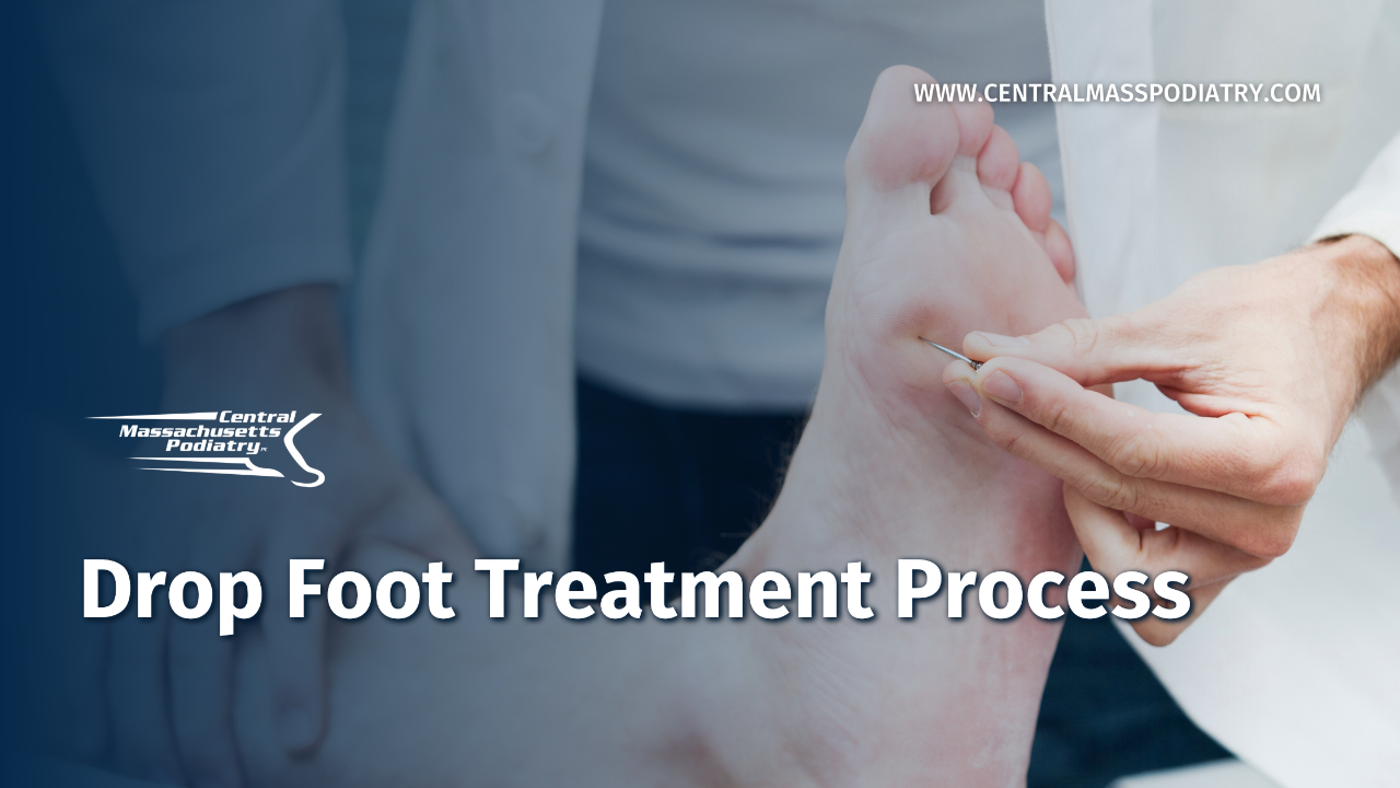 Drop Foot Treatment Process