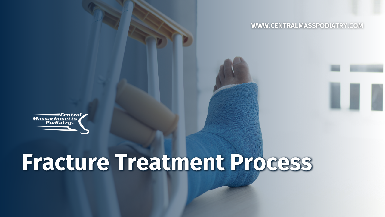 Fracture Treatment Process