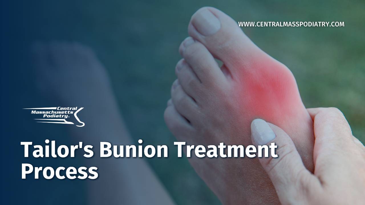 Tailor's Bunion Treatment Process