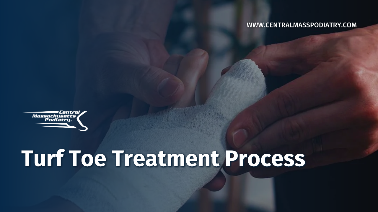 Turf Toe Treatment Process