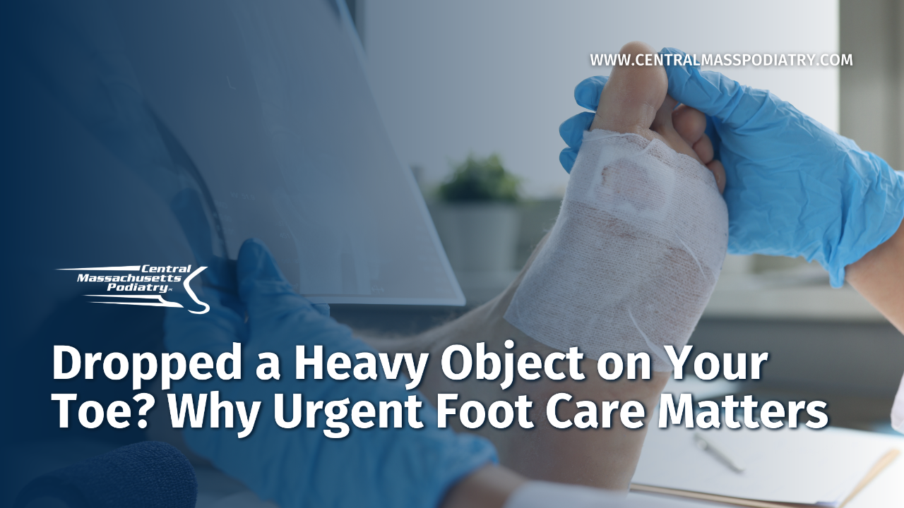 Dropped Something on Your Toe? | Central MA Podiatry