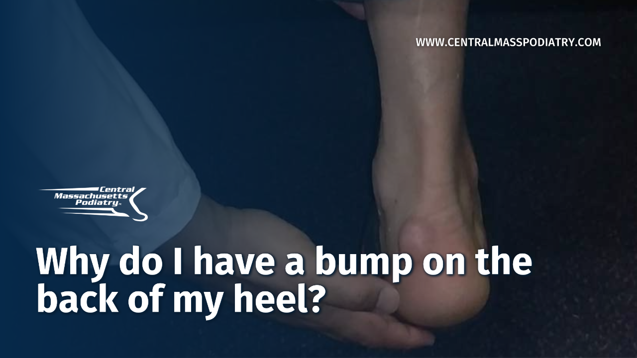 Why do I have a bump on the back of my heel?
