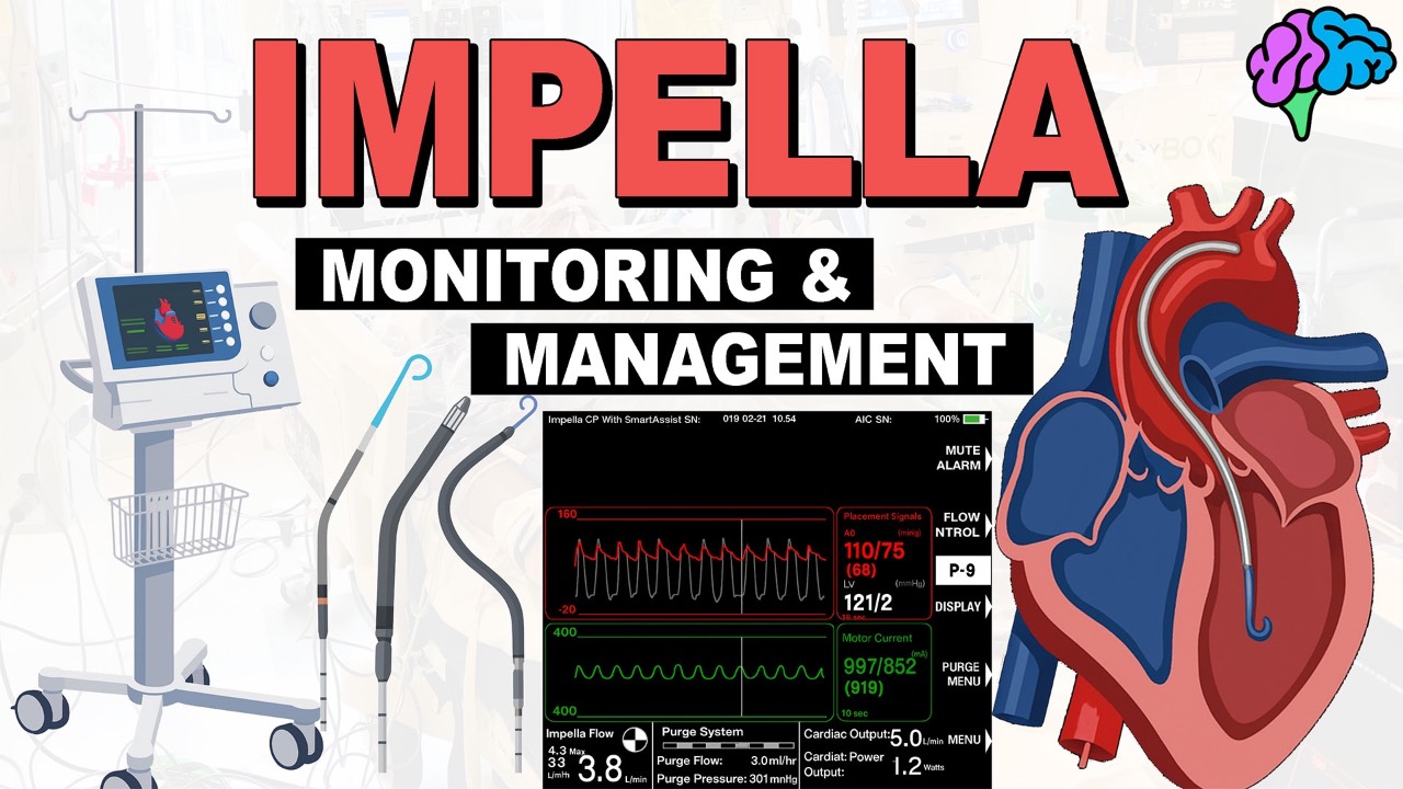 Impella Monitoring and Management Quiz