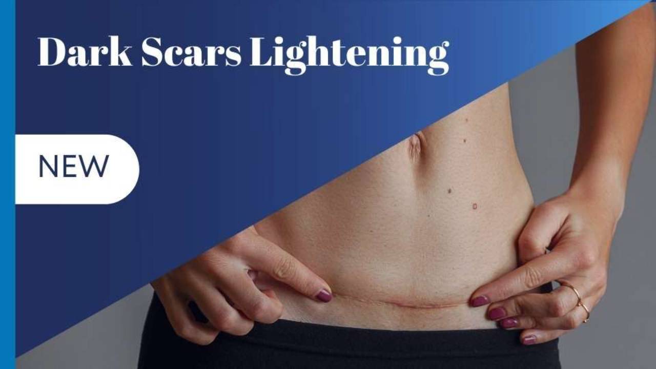 Dark Scars Lightening Training Course