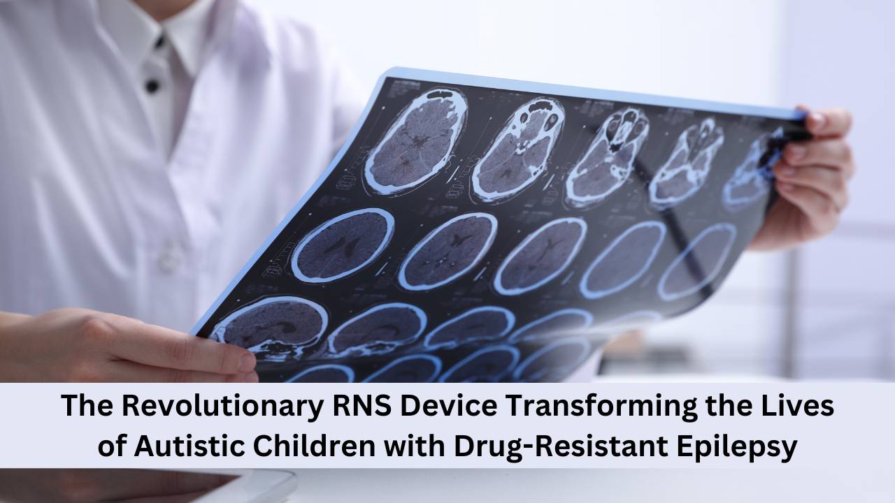 Improving the Lives of Autistic Children with Drug-Resistant Epilepsy