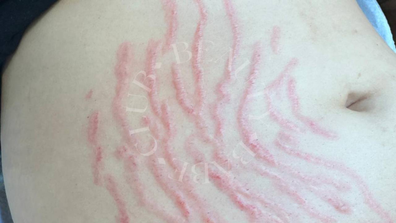 The PAS Formula: Problem, Agitation, Solution