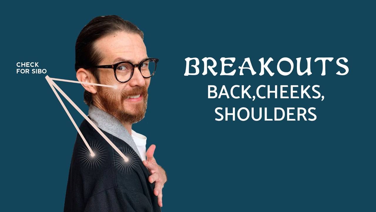 BACK, SHOULDER, AND CHEEK BREAKOUTS | Dr. Motley