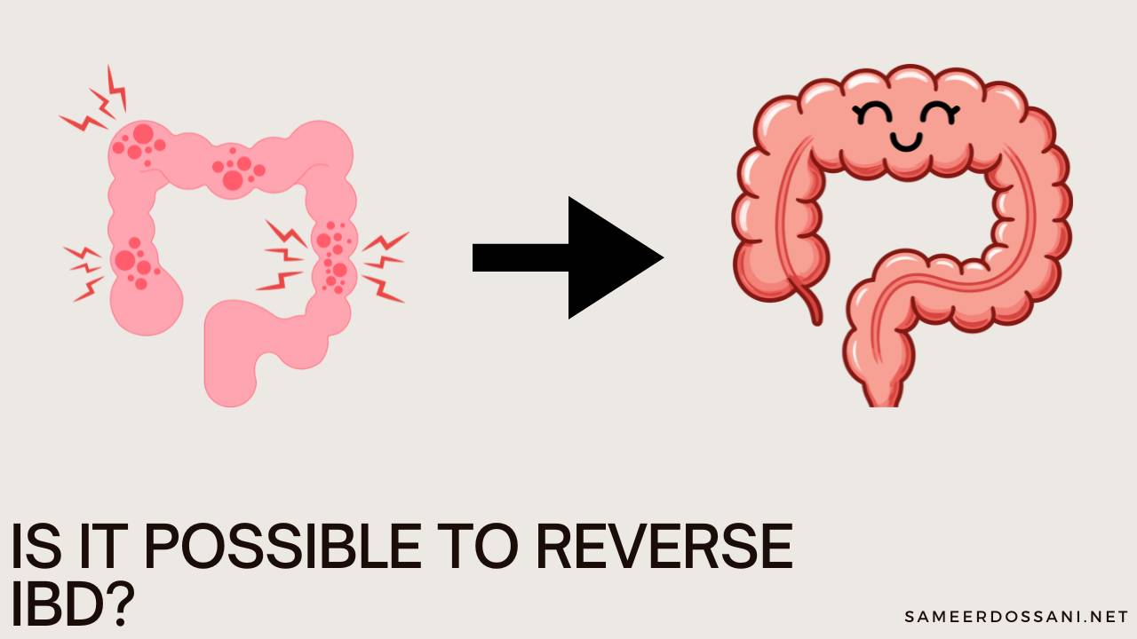 Your Path to Gut Freedom: Evidence-Based Coaching for IBD Relief