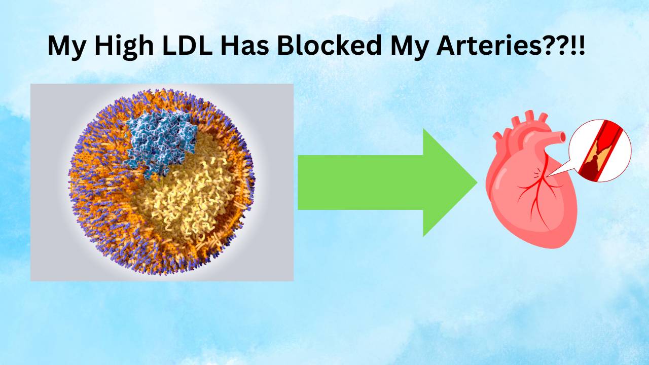 What does high cholesterol due to your heart?