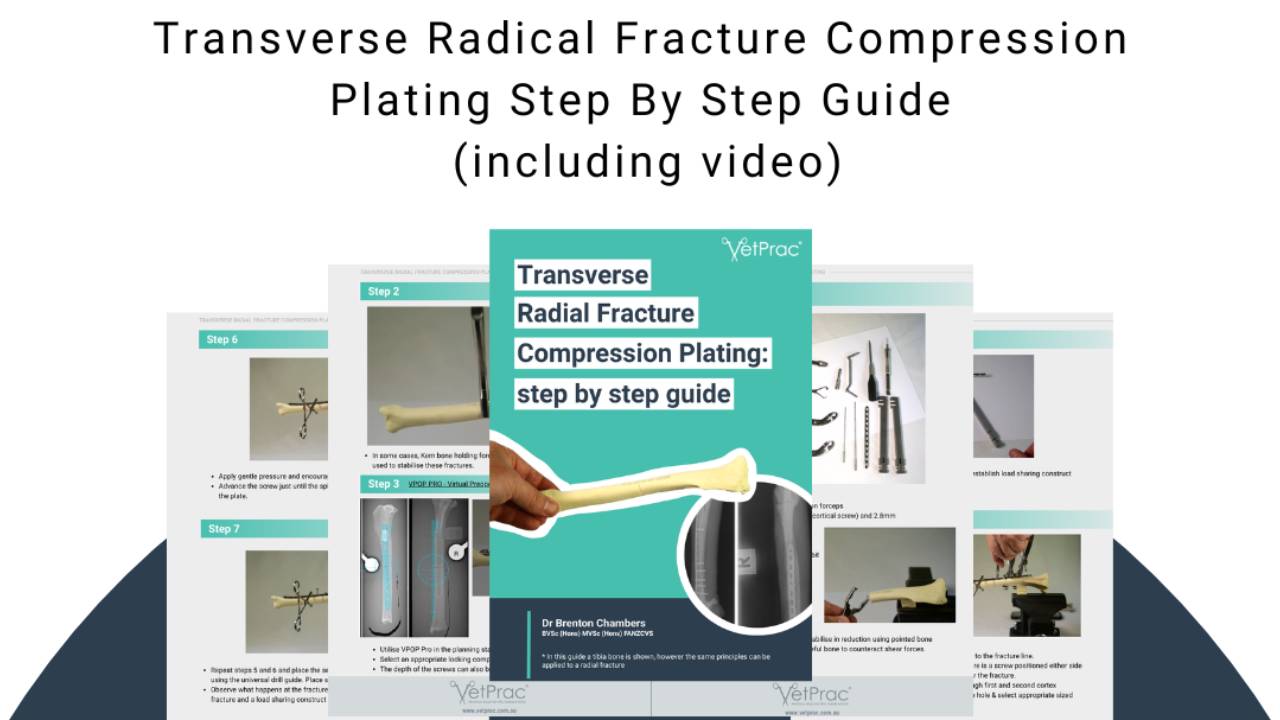 Radical Fractures Step by Step Guide