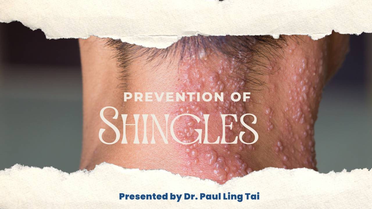 The Prevention of Shingles