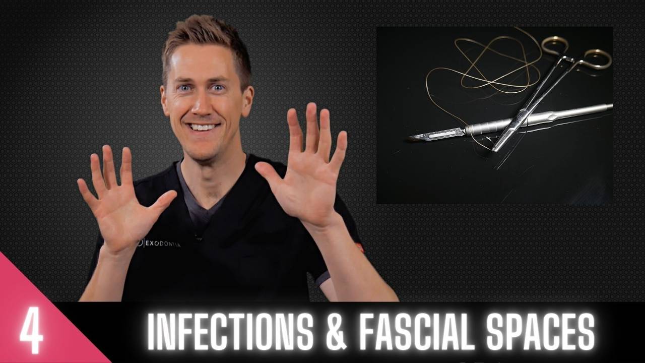 Module 4: Infections & Fascial Spaces