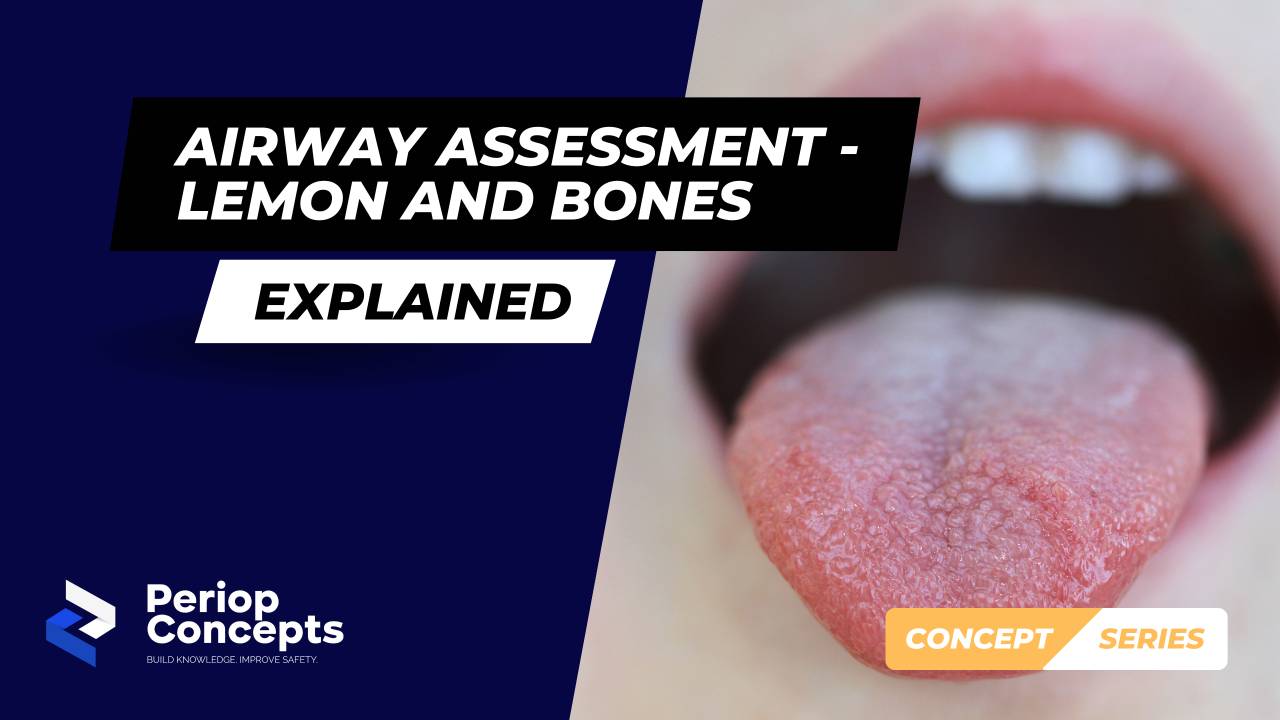 Airway assessment mnemonics - LEMON and BONES
