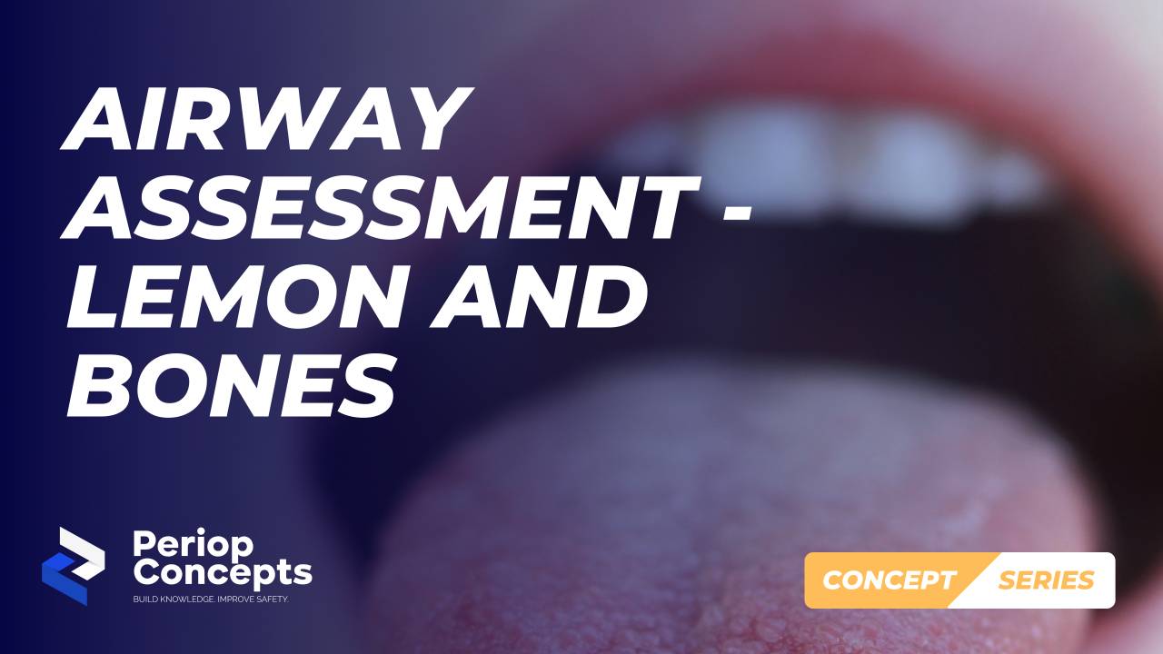 Airway assessment mnemonics - LEMON and BONES