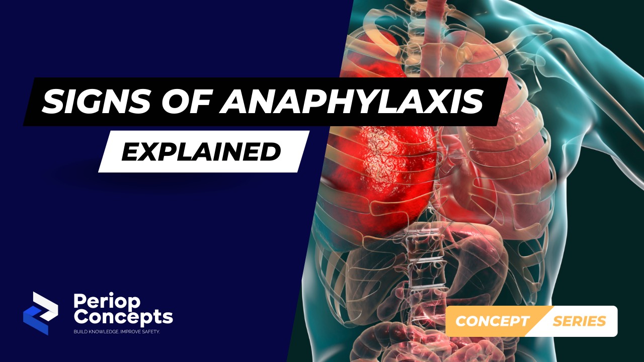 Signs of Anaphylaxis