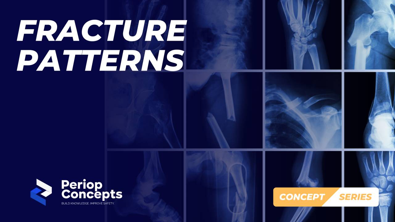Fracture Patterns