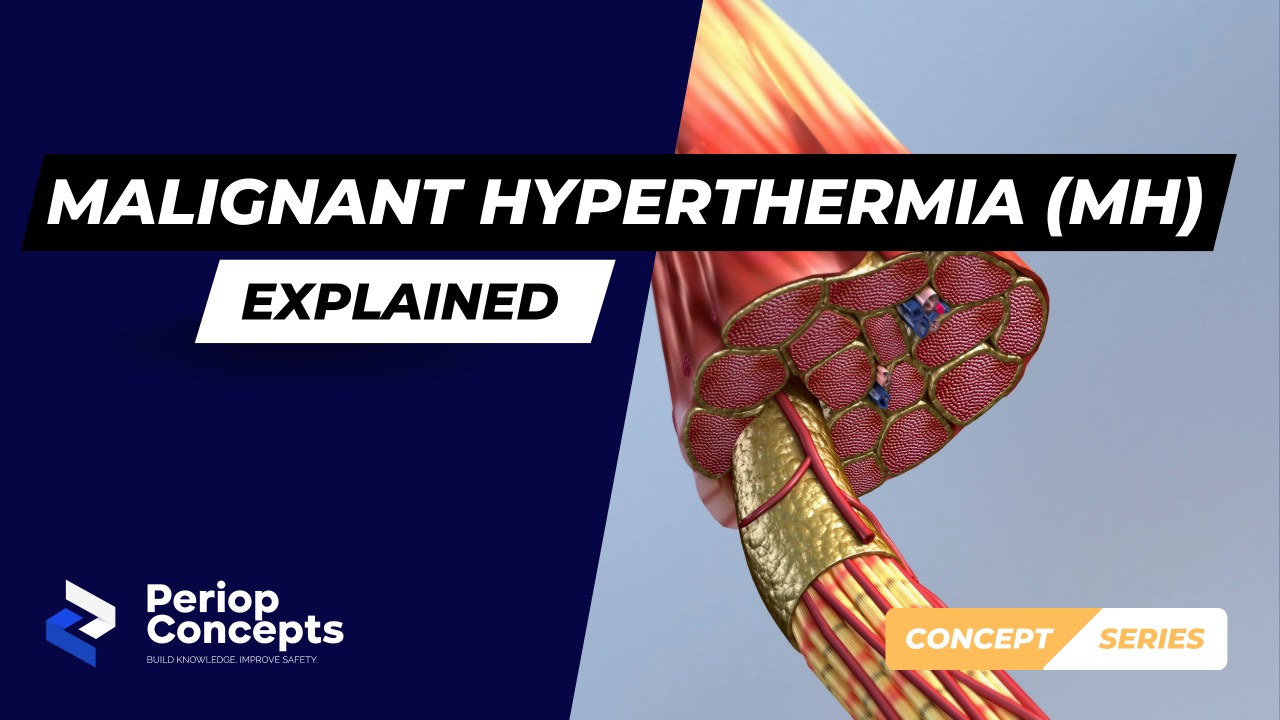 Malignant Hyperthermia (MH)