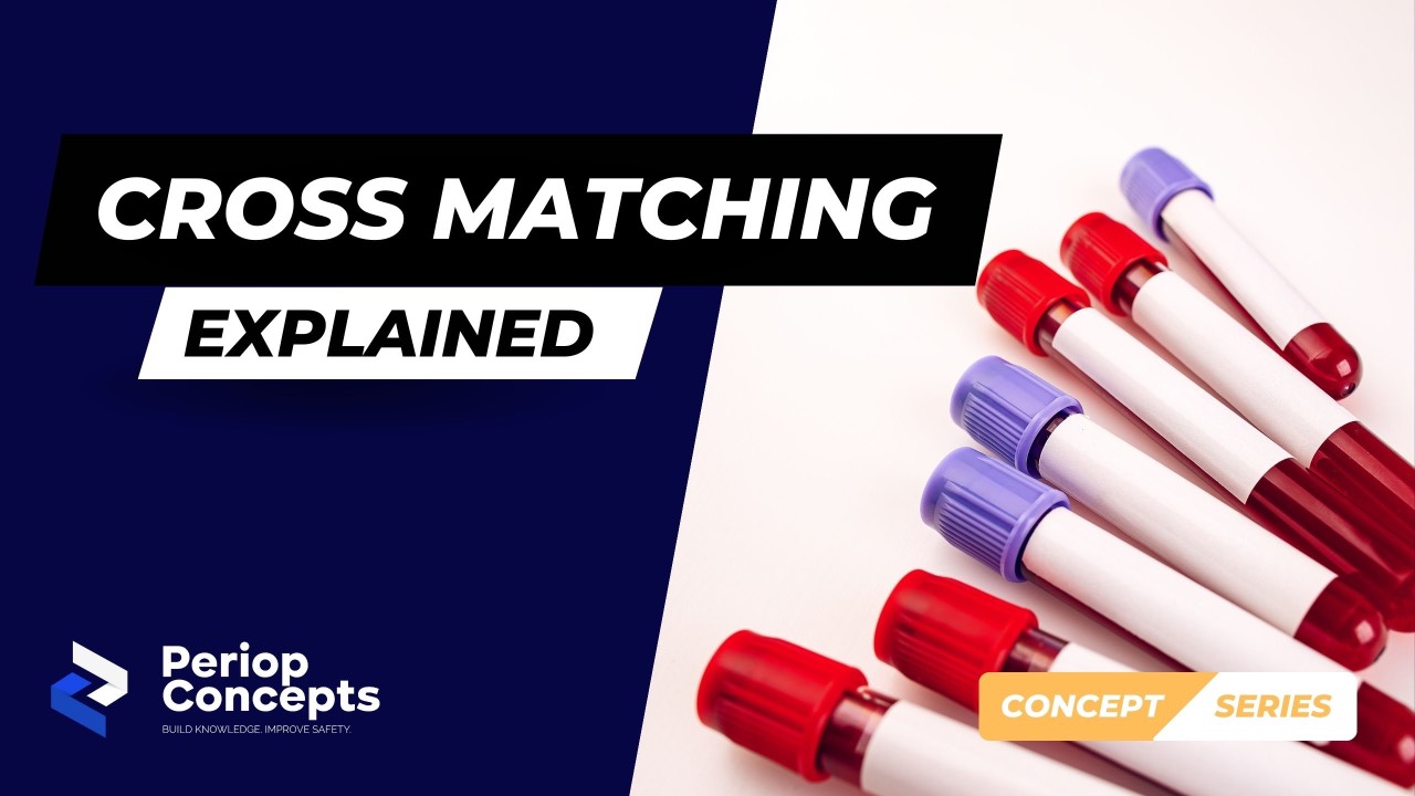 Cross Matching