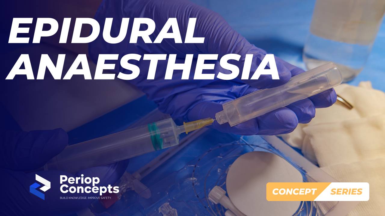epidural anaesthesia