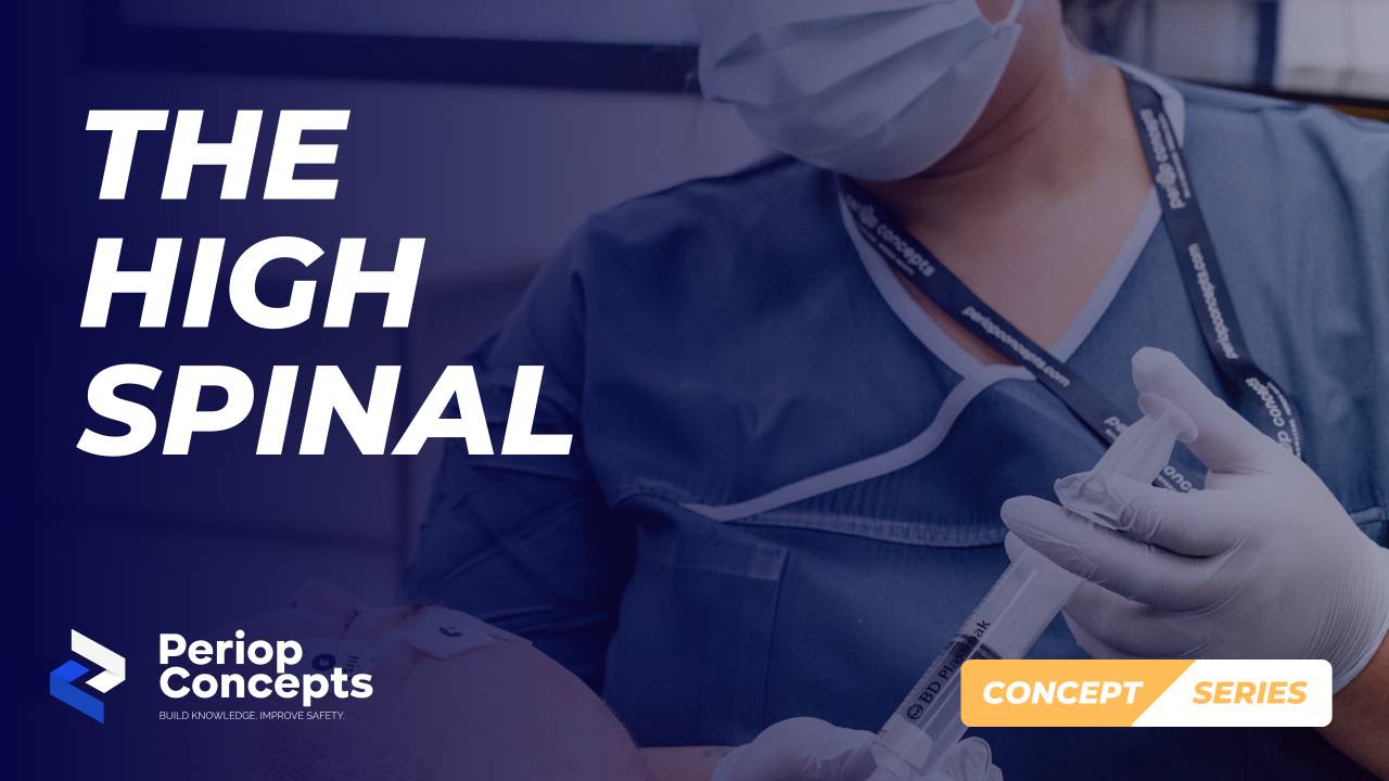 The High Spinal Block Explained