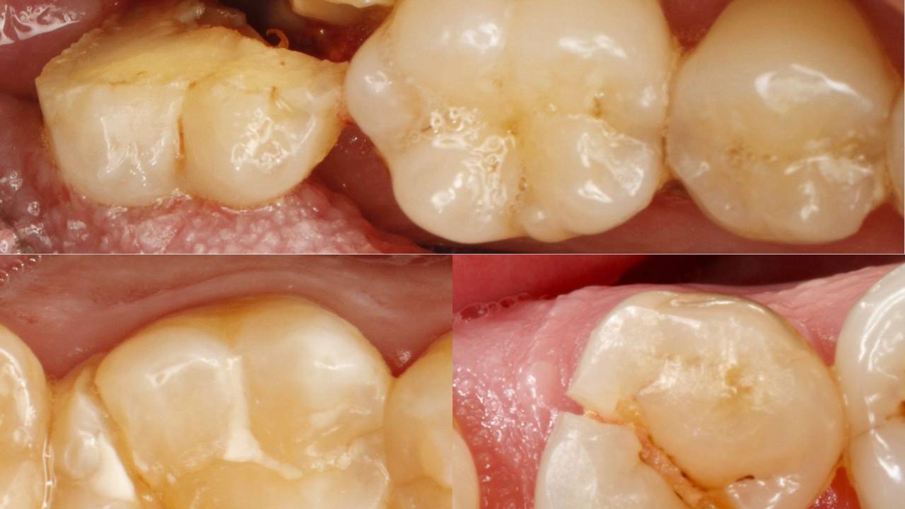 How to Get Started Working in the Aesthetic Zone