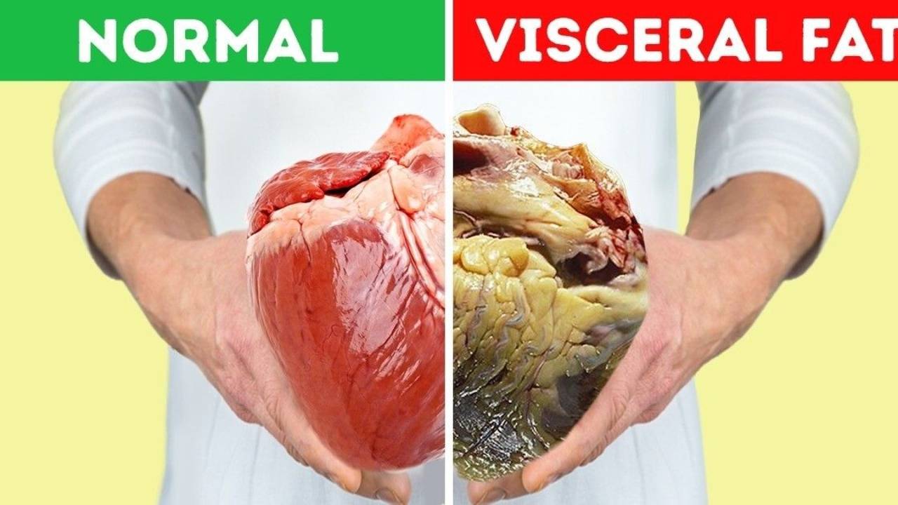 The Complete Guide To Losing Visceral Fat
