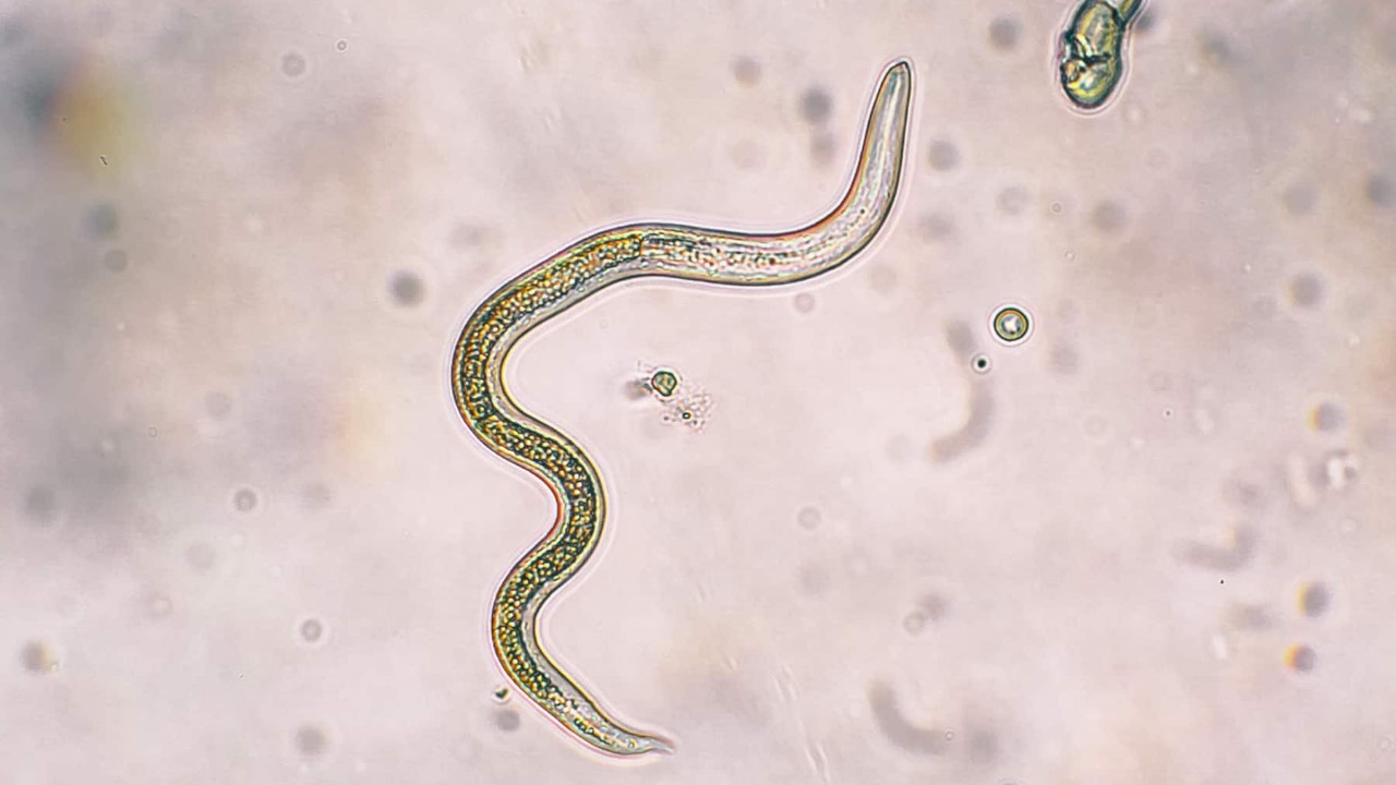 Real Parasite Cases: What I’ve Seen (and What You Should Know)