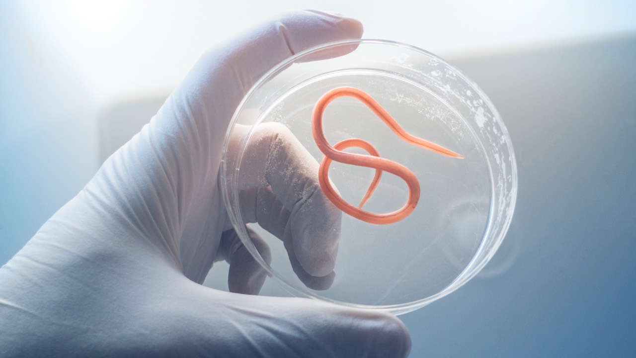 Parásitos intestinales vs colon irritable