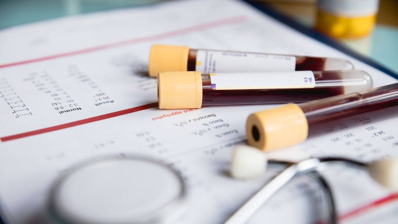 Top 5 Blood Tests to Add to Your Annual Physical for Optimal Health