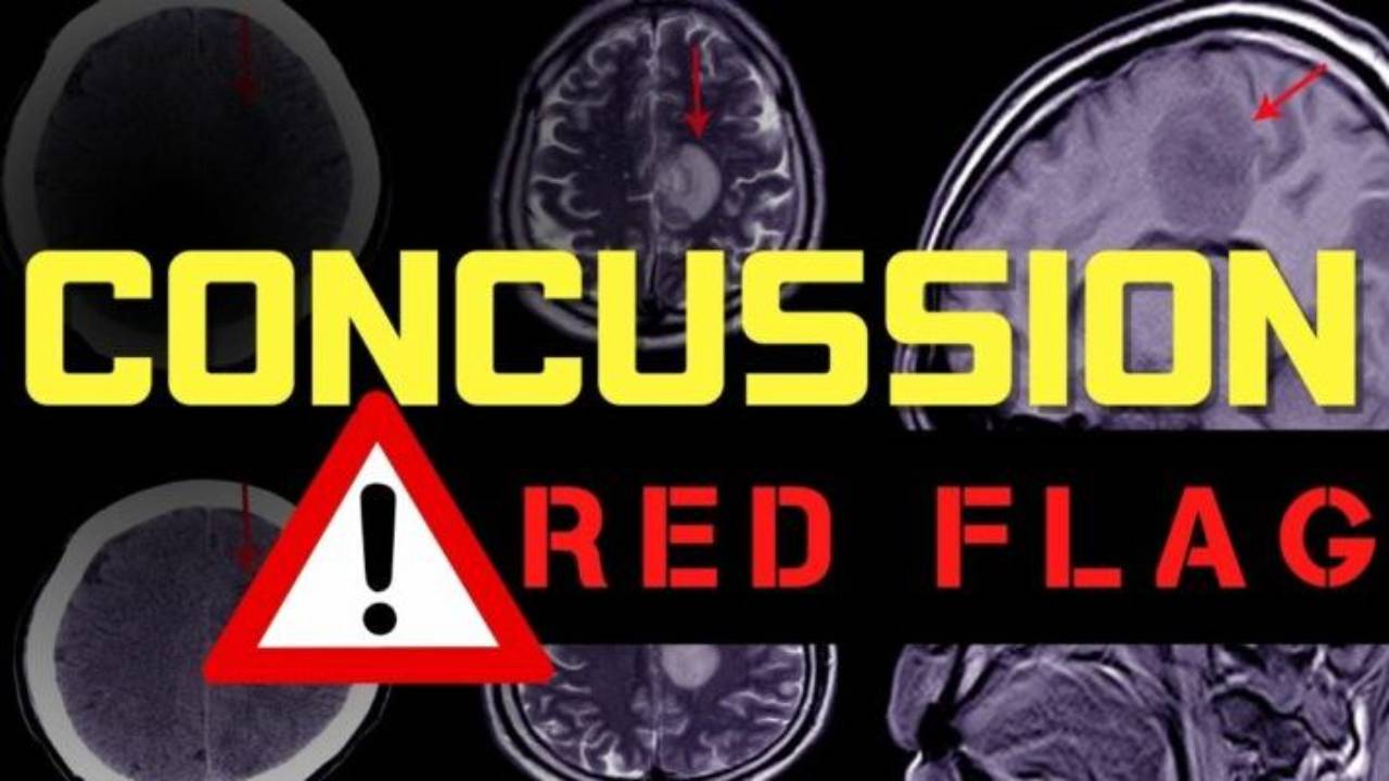 Red Flags for a Concussion
