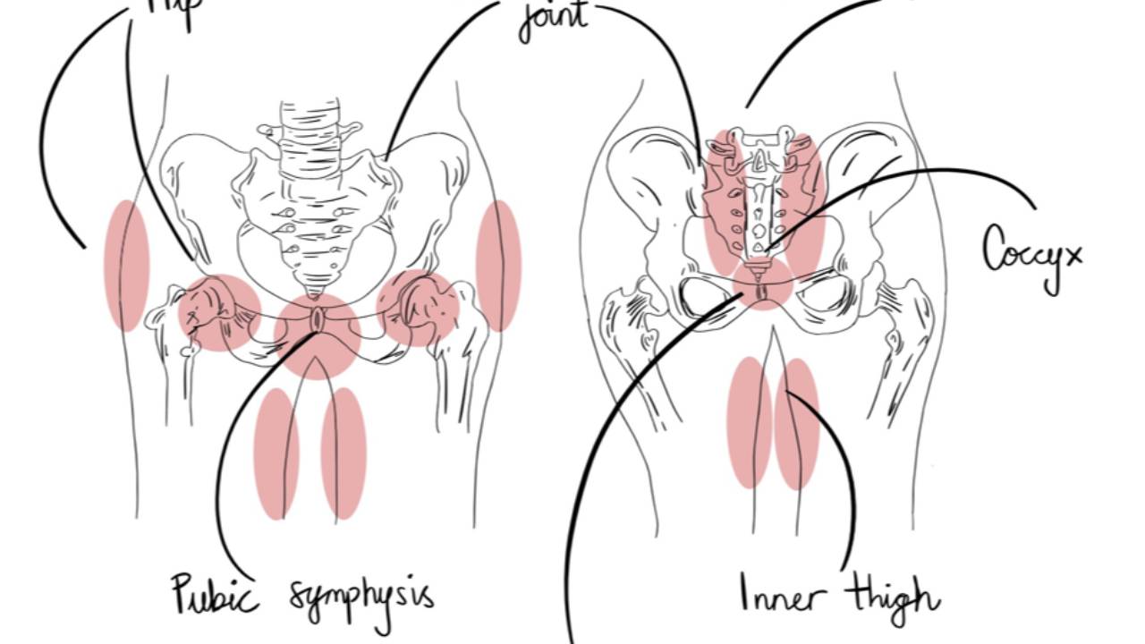Pelvic Floor Assessment Part 2: Pain management within PF Dysfunction