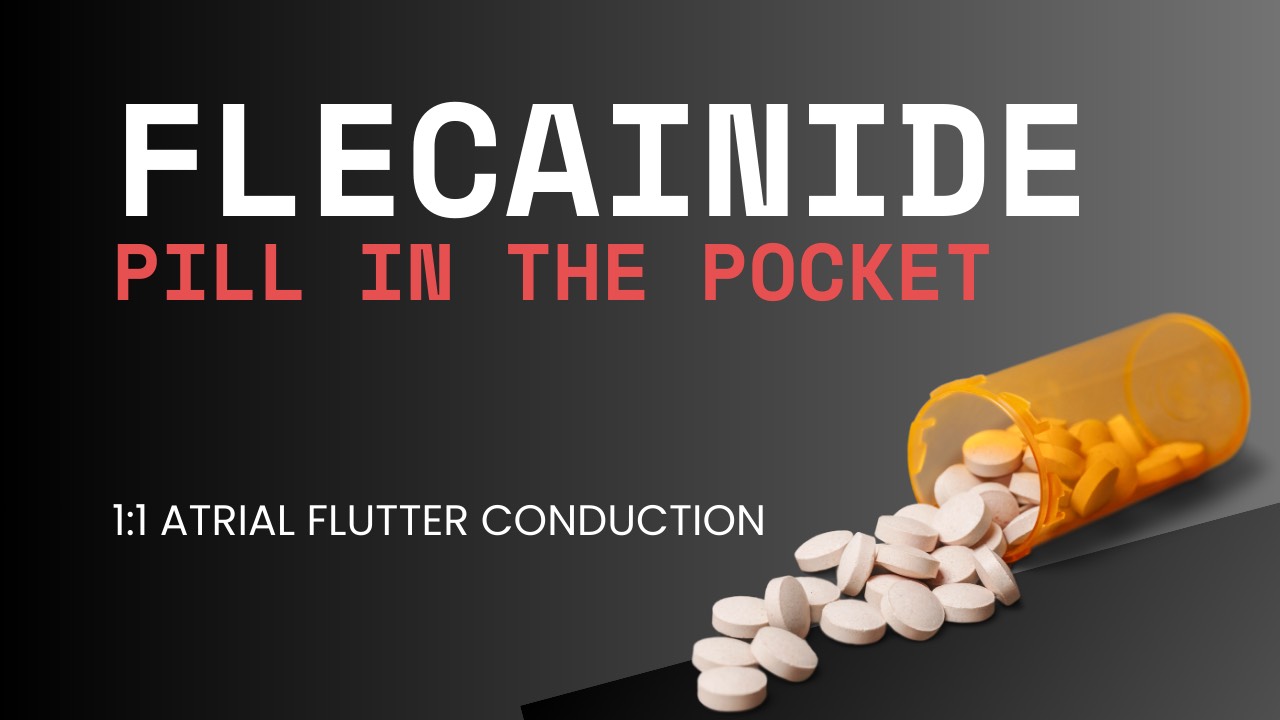 Beware 1:1 conduction with 'Pill in the Pocket' Flecainide for A Fib