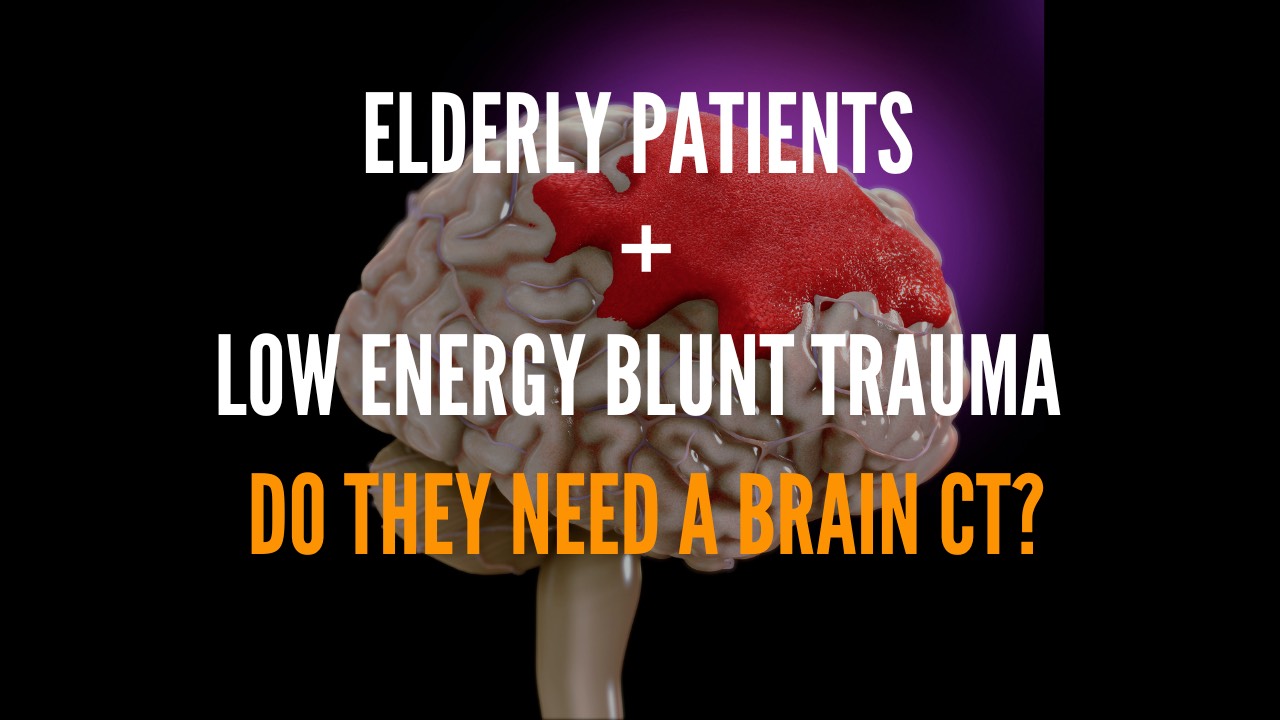 Do all elderly patients with blunt head trauma need a CT Brain?
